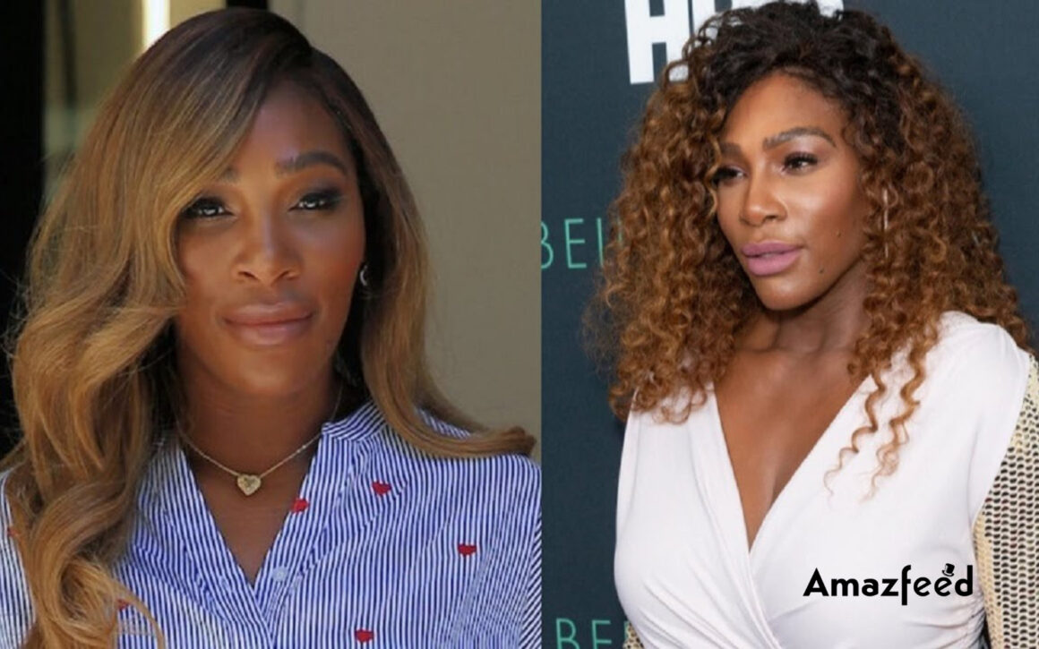 Serena Williams Plastic Surgery Before And After Look | Is Serena ...
