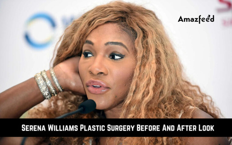 Serena Williams Plastic Surgery Before And After Look | Is Serena ...